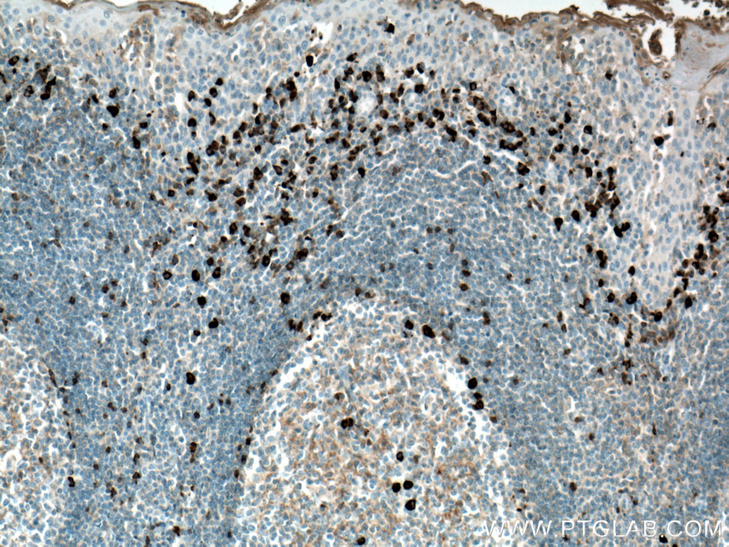 Heavy chain of IgG4 Antibody 66408-1-Ig | Proteintech