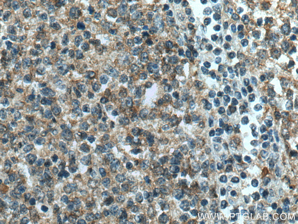 IL-4R Antibody 28331-1-AP | Proteintech