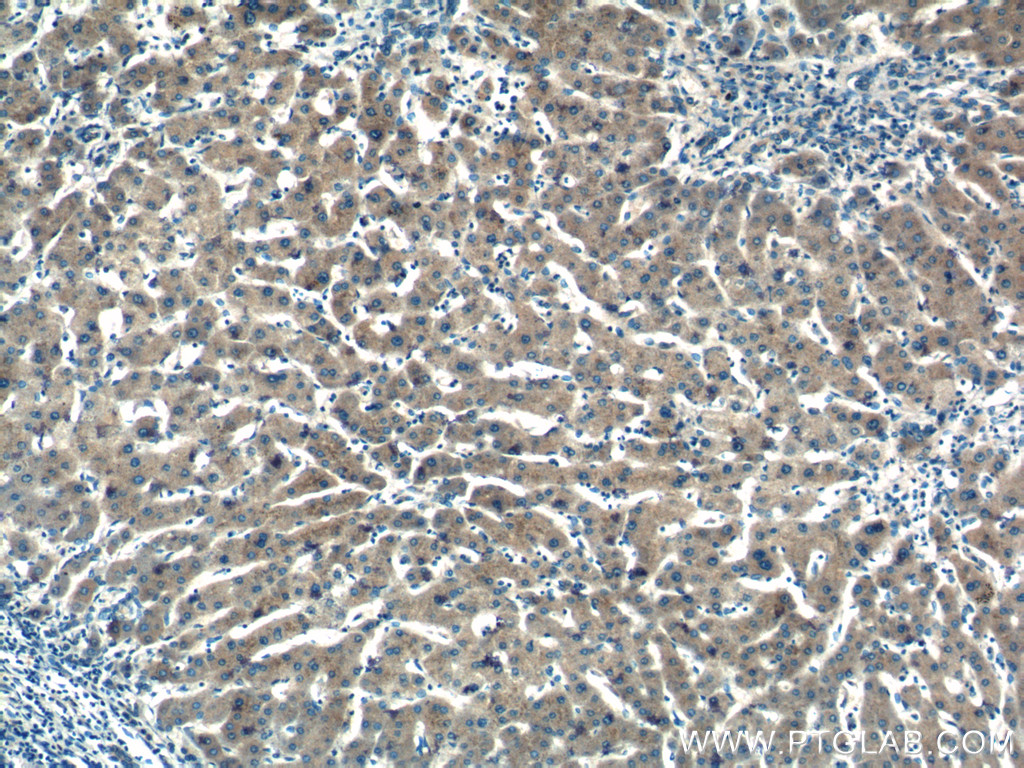 IL-6 Antibody 21865-1-AP | Proteintech