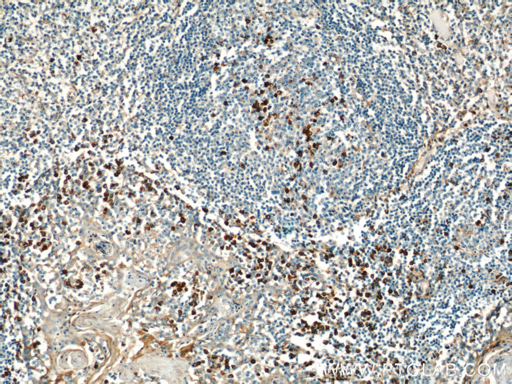 IL-6 Antibody 21865-1-AP | Proteintech