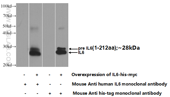 IL-6 Antibody 66146-1-Ig | Proteintech