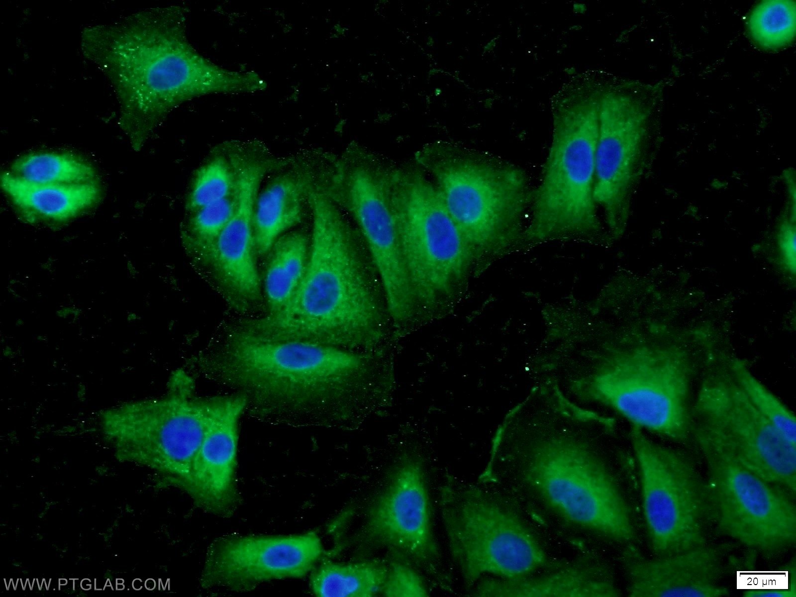 Inhibin Beta A Antibody 10651-1-AP | Proteintech