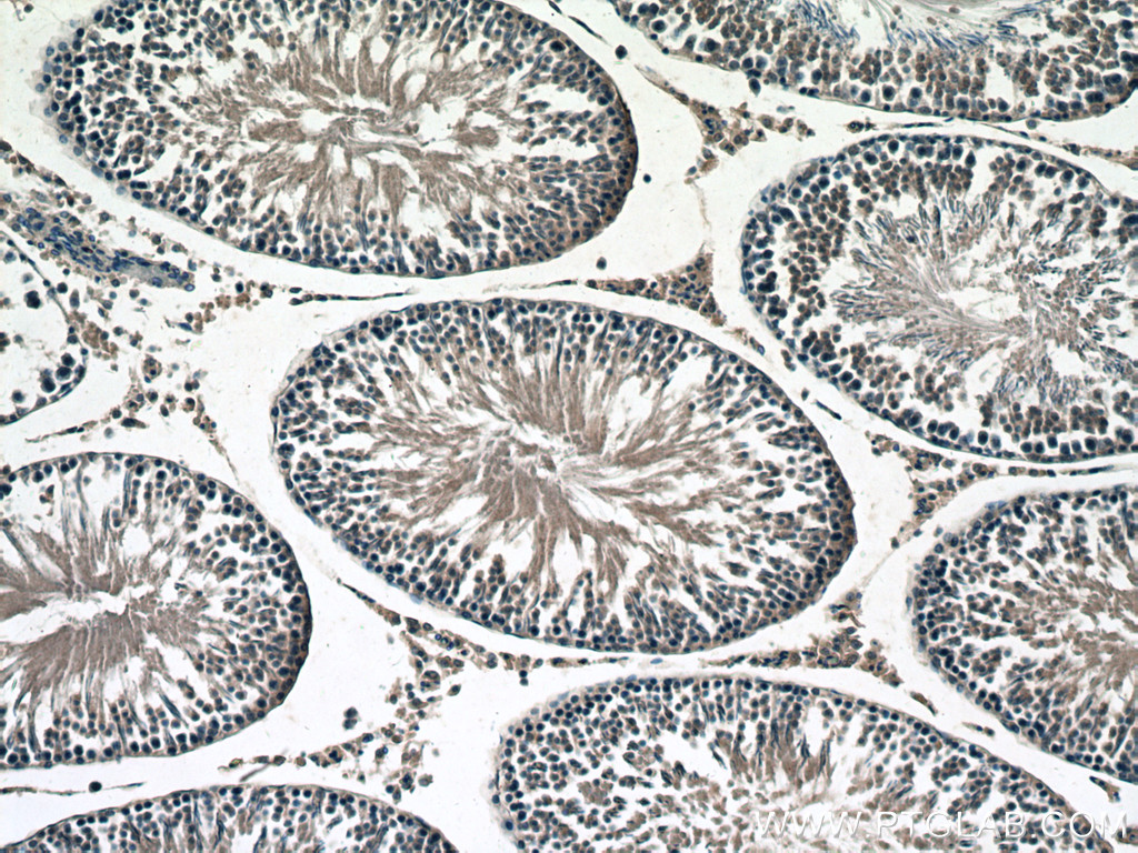 Inhibin Beta B Antibody 17577-1-AP | Proteintech