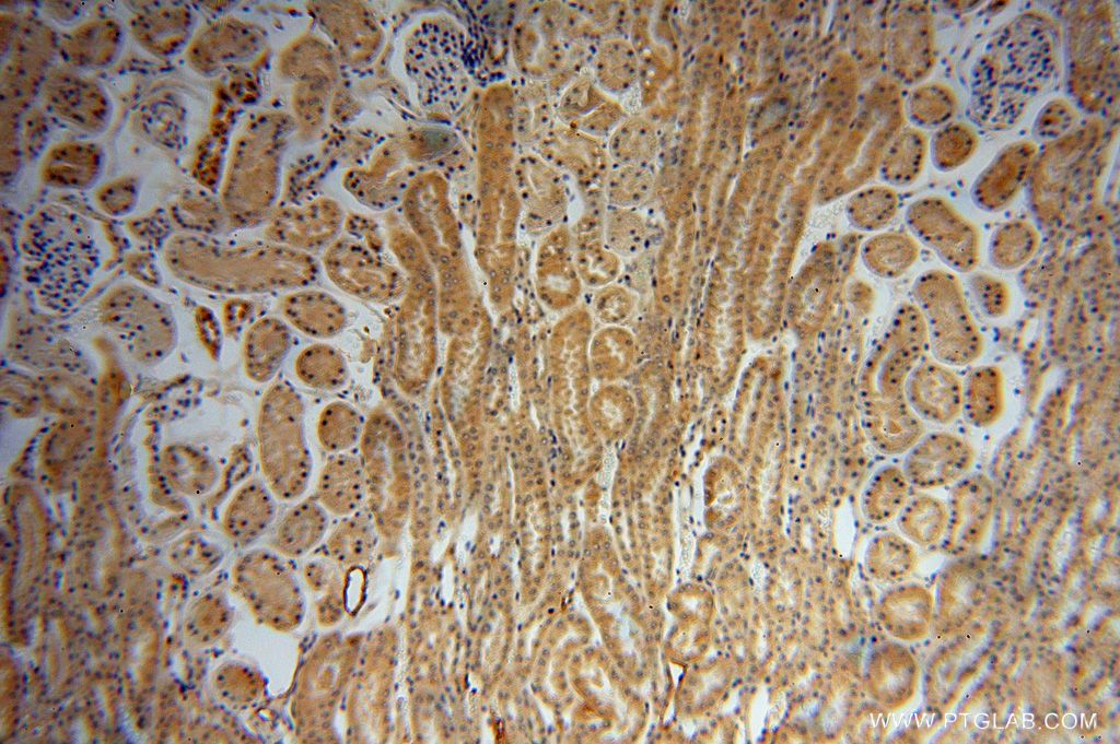 Inhibin Beta B Antibody 17577-1-AP | Proteintech