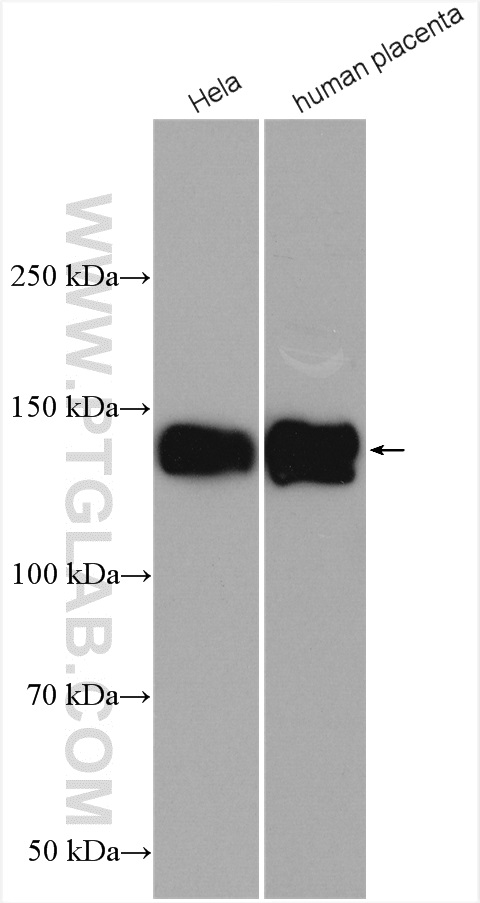 Integrin Alpha-5 Antibody 10569-1-AP | Proteintech