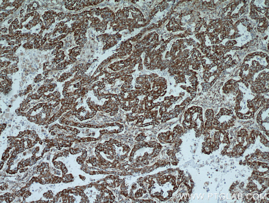 Integrin beta-6 Antibody 21703-1-AP | Proteintech