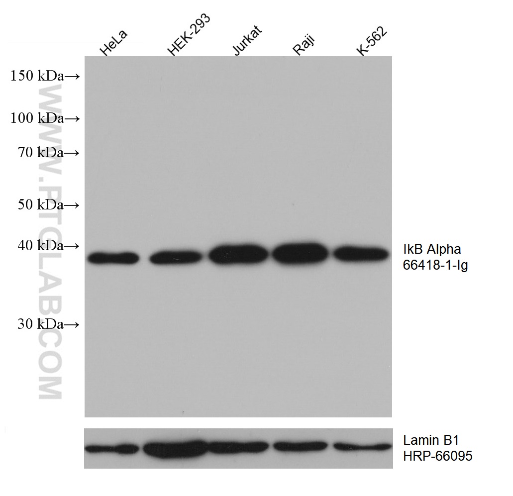 IkB Alpha Antibody 66418-1-Ig | Proteintech