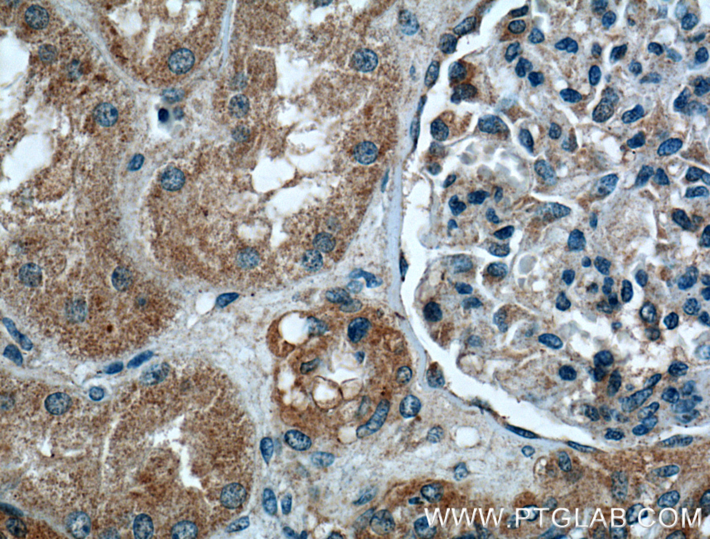 Integrin Alpha 6 Antibody 27189-1-AP | Proteintech