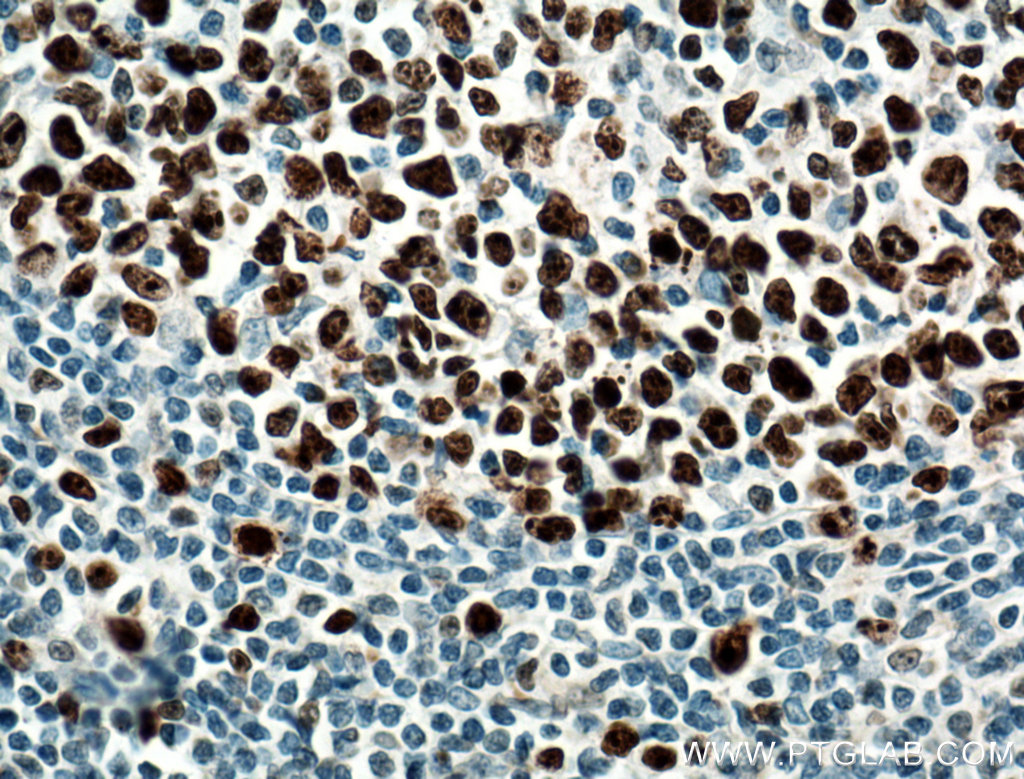 KI67 Antibody 27309-1-AP | Proteintech