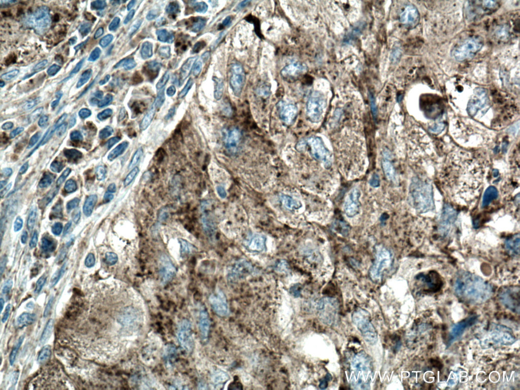 LAMP2 Antibody 27823-1-AP | Proteintech