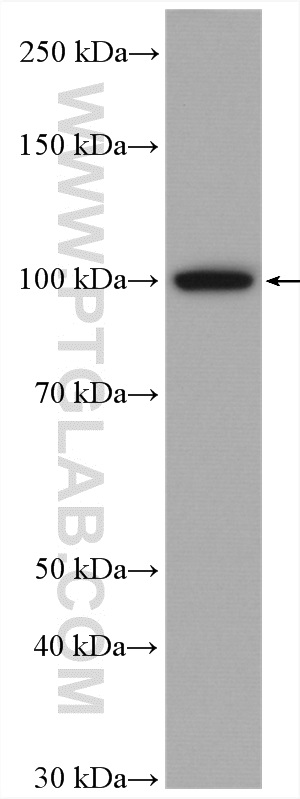 LONP1 Antibody 15440-1-AP | Proteintech