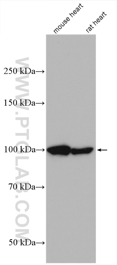 LONP1 Antibody 15440-1-AP | Proteintech