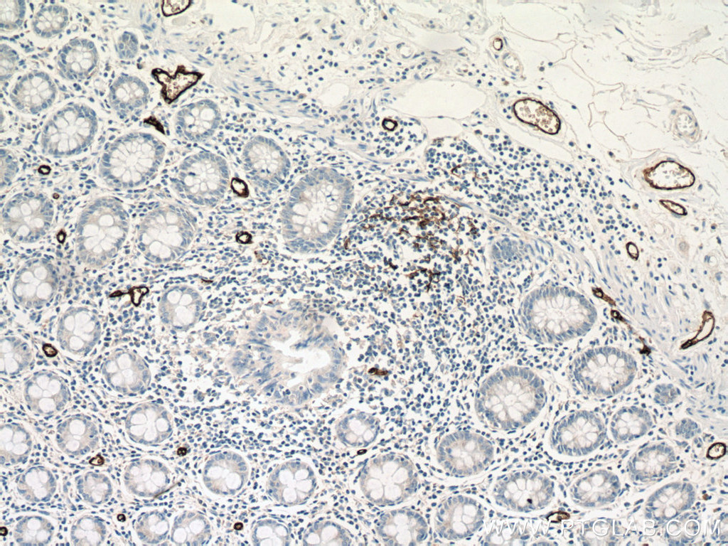 MAdCAM1 Antibody 66594-1-Ig | Proteintech