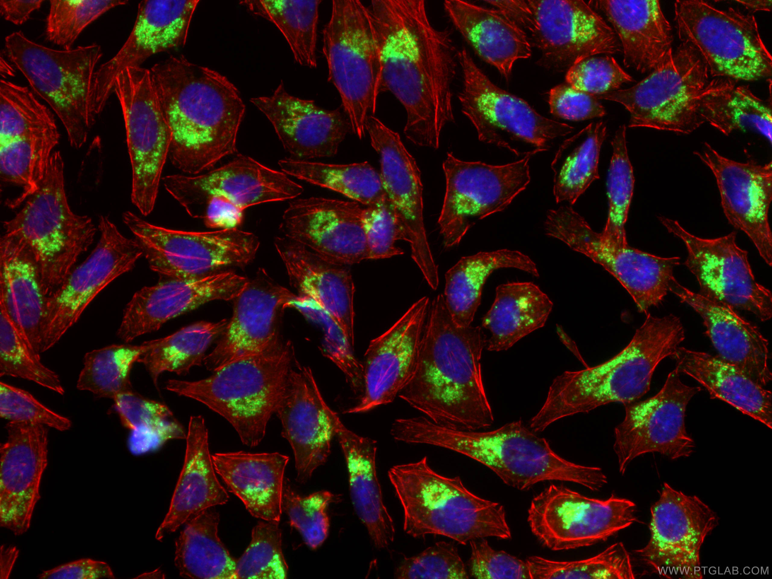LC3 Antibody 14600-1-AP | Proteintech