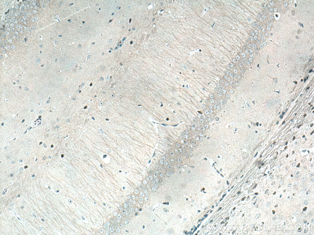 LC3B-Specific Antibody 18725-1-AP | Proteintech