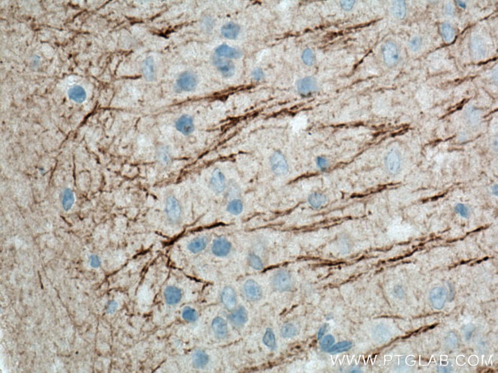MAP2 Antibody 67015-1-Ig | Proteintech