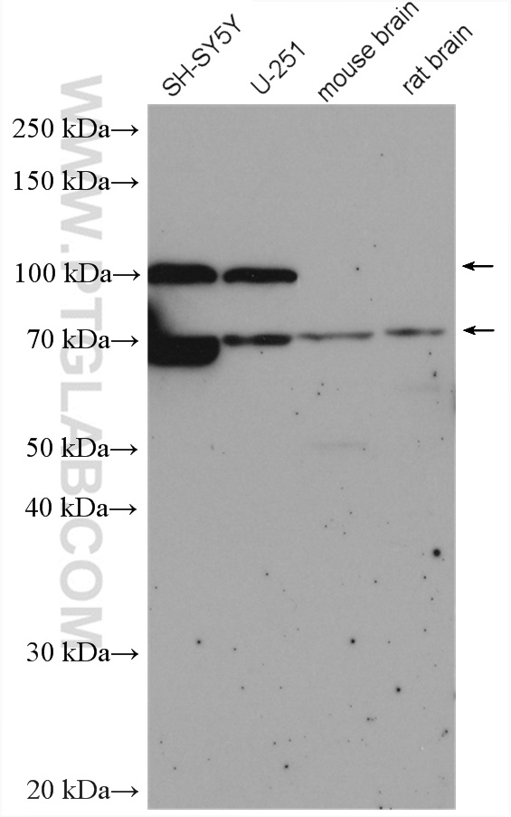 TAU Antibody 10274-1-AP | Proteintech