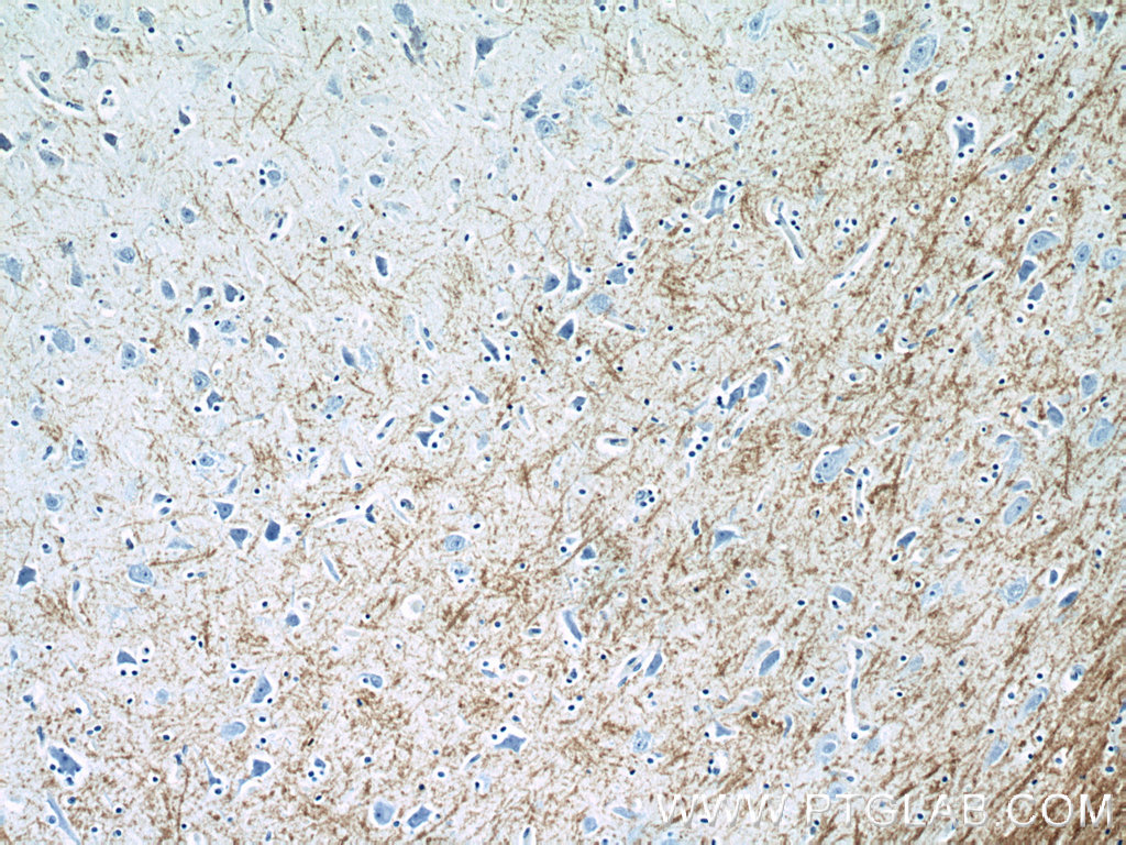 Myelin basic protein Antibody 10458-1-AP | Proteintech