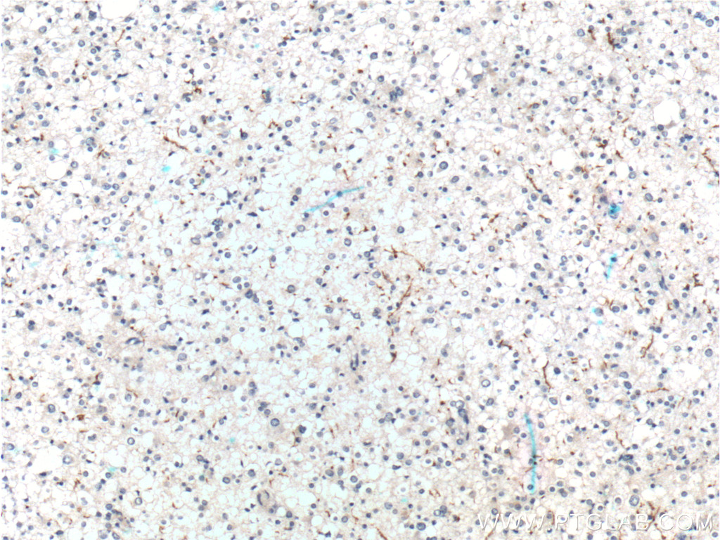 Myelin basic protein Antibody 10458-1-AP | Proteintech