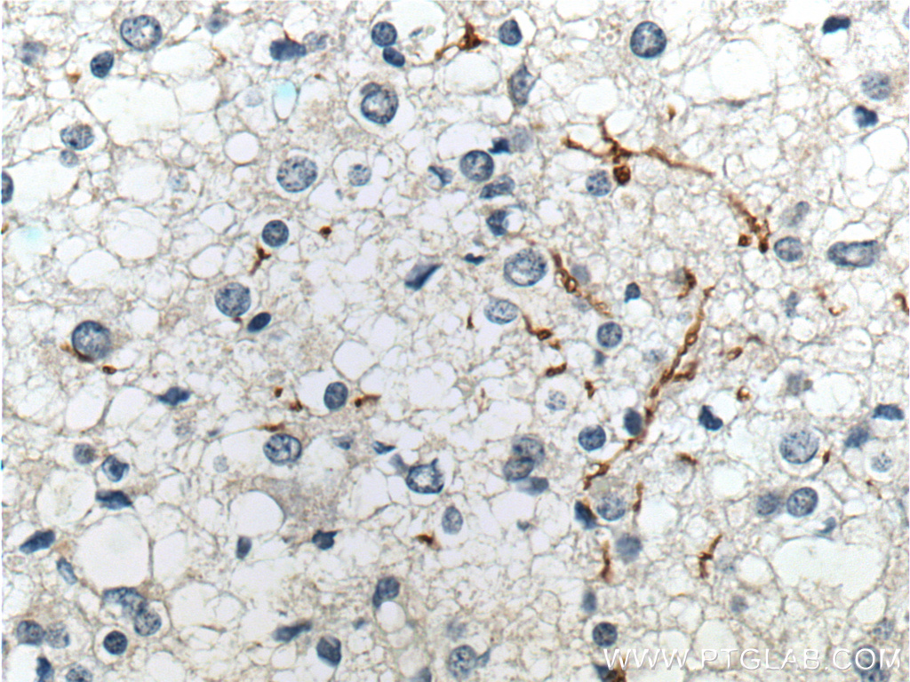 Myelin basic protein Antibody 10458-1-AP | Proteintech
