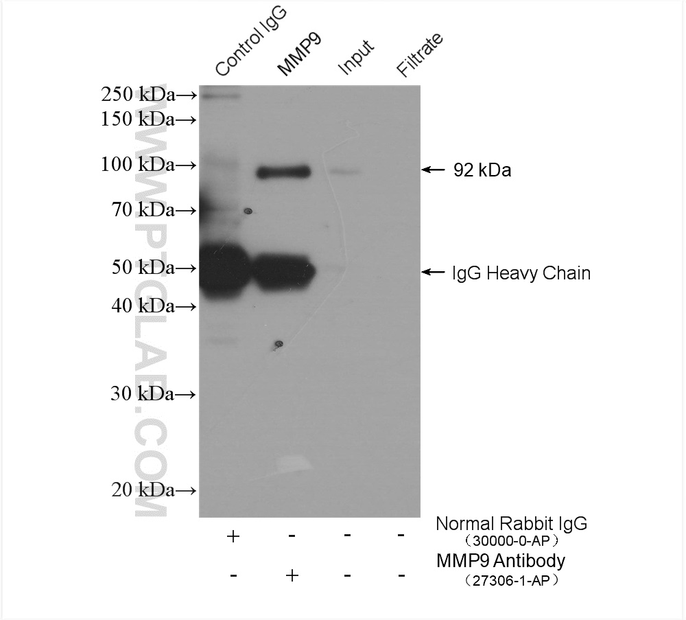MMP9 (Middle) Antibody 27306-1-AP | Proteintech