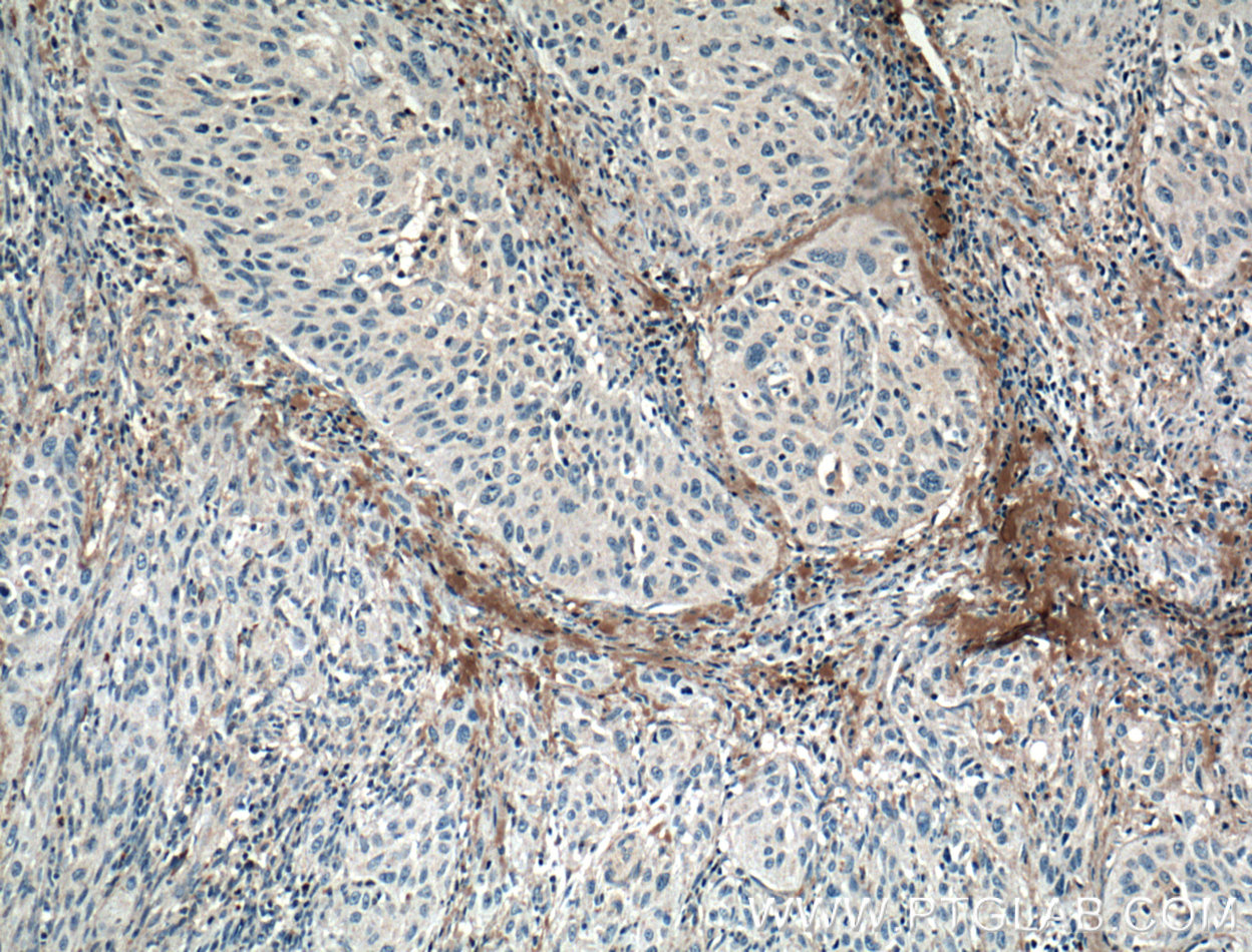 MMP9 (N-terminal) Antibody 10375-2-AP | Proteintech