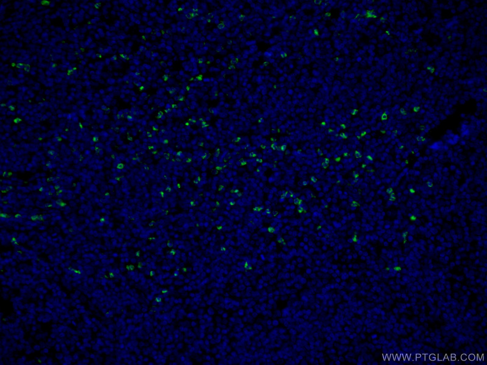 MPO Antibody 22225-1-AP | Proteintech