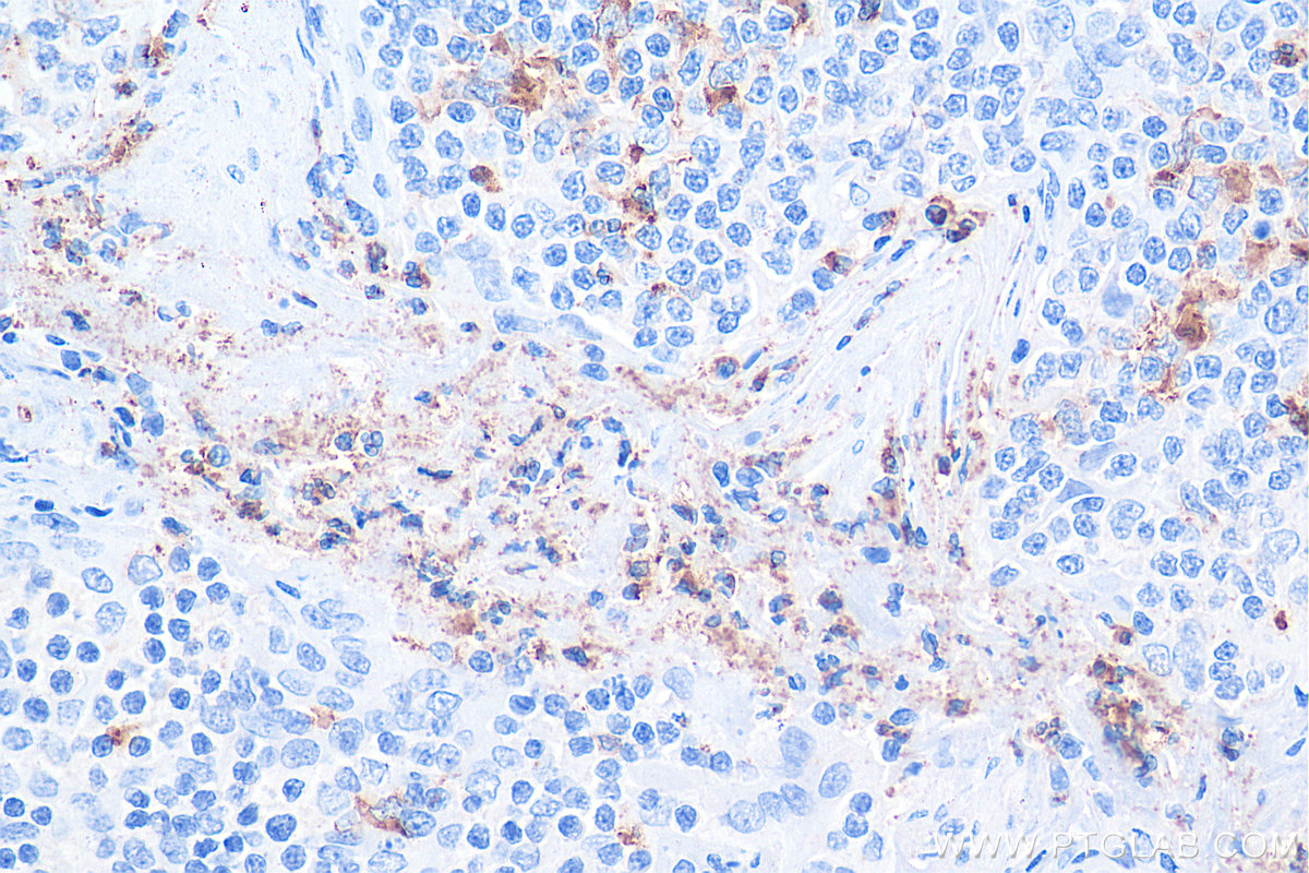 MPO Antibody 66177-1-Ig | Proteintech