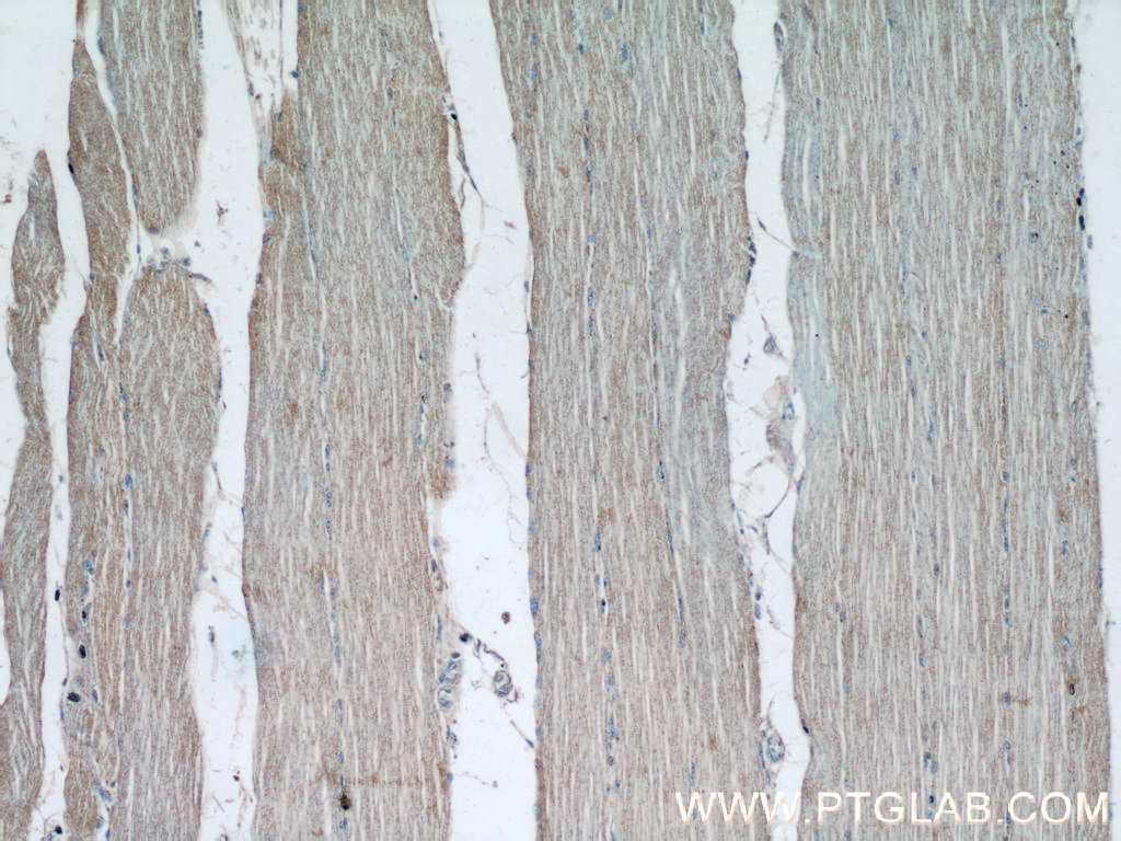 MRAS Antibody 14213-1-AP | Proteintech