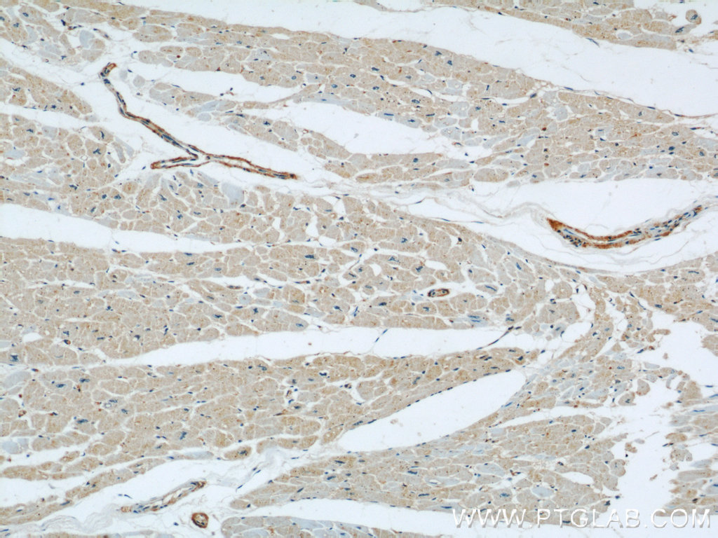 MRAS Antibody 14213-1-AP | Proteintech
