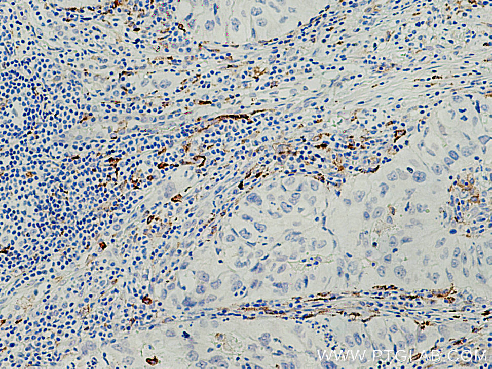 CD206 Antibody 60143-1-Ig | Proteintech