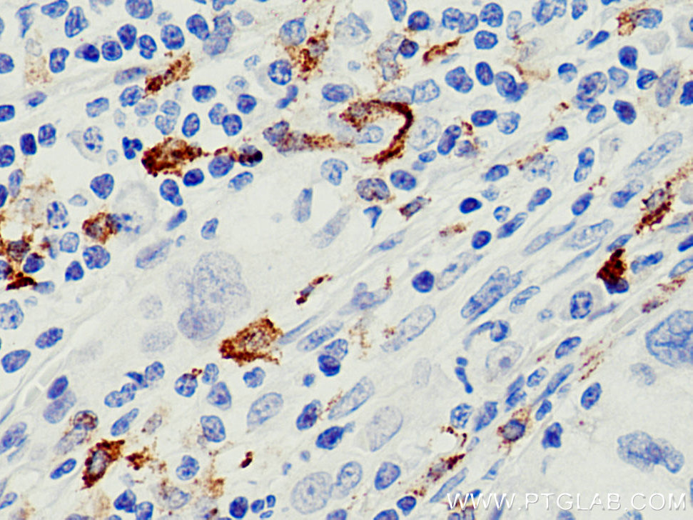 CD206 Antibody 60143-1-Ig | Proteintech
