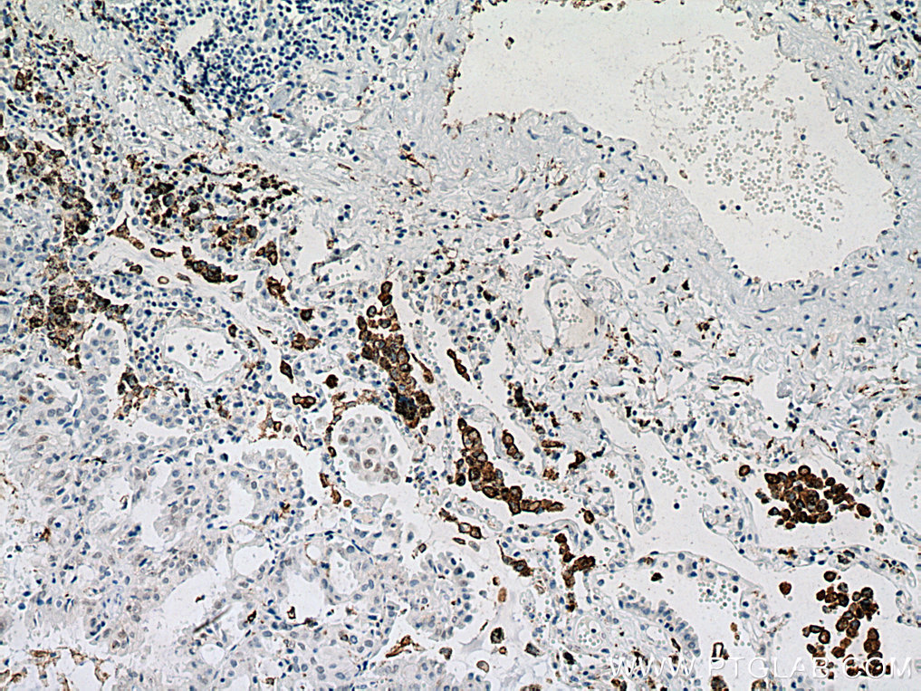 CD206 Antibody 60143-1-Ig | Proteintech