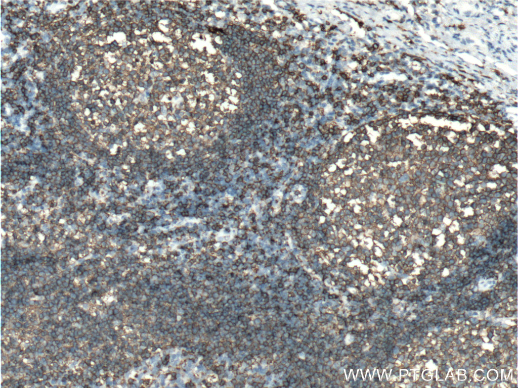 CD20 Antibody 24828-1-AP | Proteintech