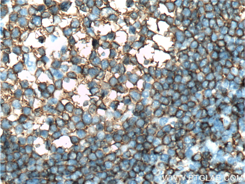 CD20 Antibody 24828-1-AP | Proteintech