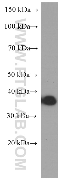 CD20 Antibody 60271-1-Ig | Proteintech