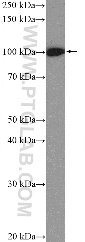MSH2 Antibody 15520-1-AP | Proteintech