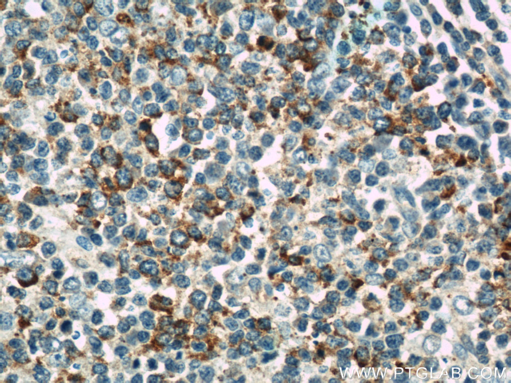 MX1 Antibody 13750-1-AP | Proteintech