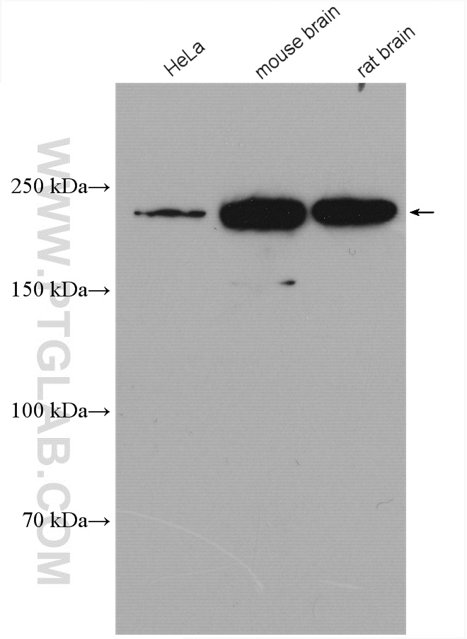 MYH10-Specific Antibody 19673-1-AP | Proteintech