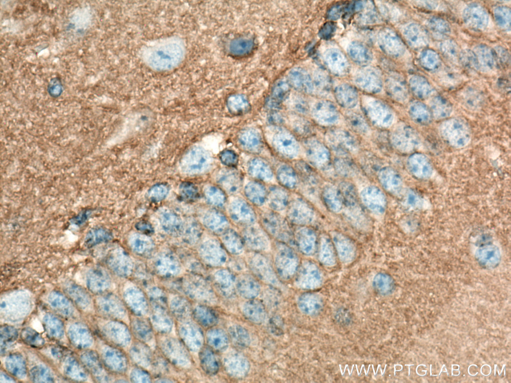 NCAM1/CD56 Antibody 14255-1-AP | Proteintech