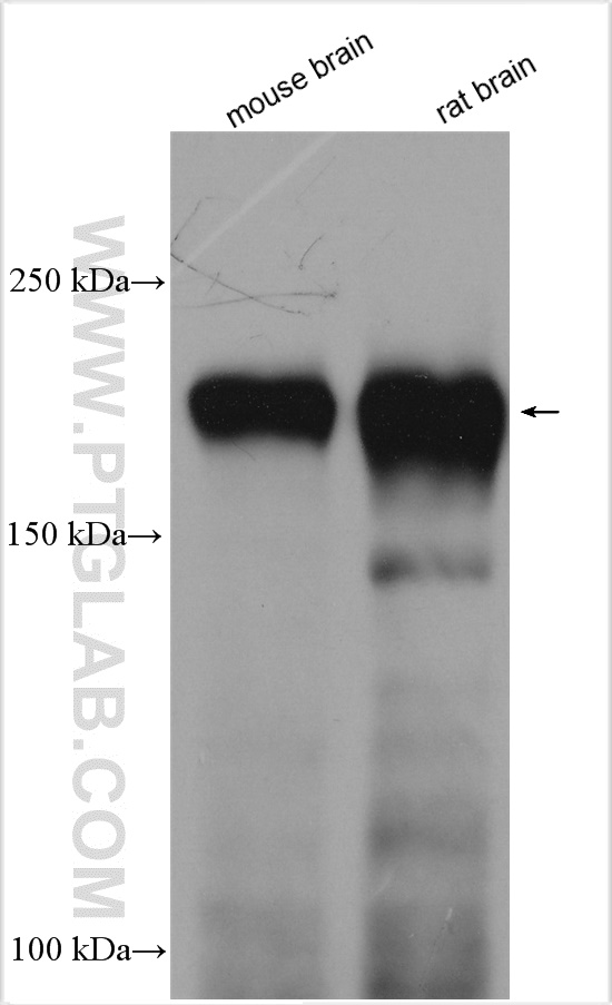NF-H/NF200 antibody (18934-1-AP) | Proteintech | 武汉三鹰生物技术有限公司