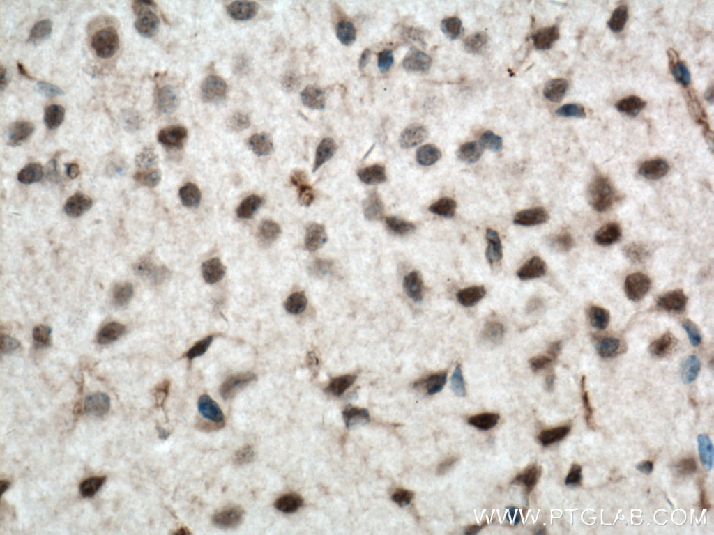 iNOS Antibody 18985-1-AP | Proteintech