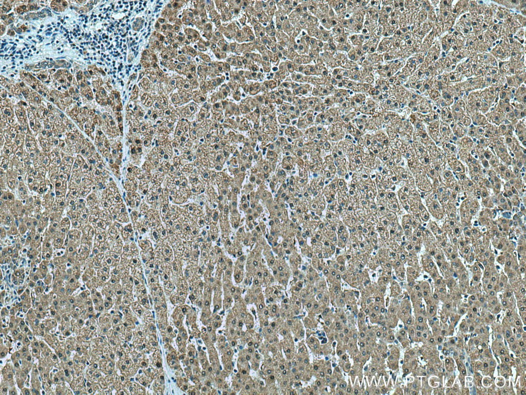 iNOS Antibody 18985-1-AP | Proteintech