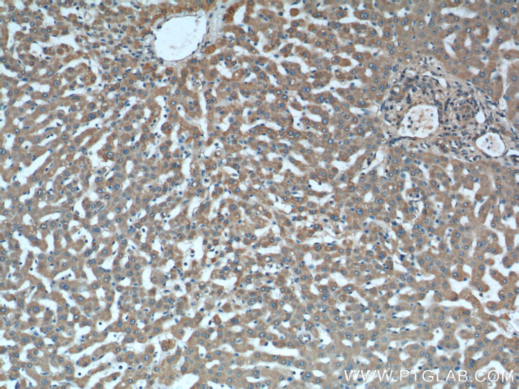 iNOS Antibody 18985-1-AP | Proteintech