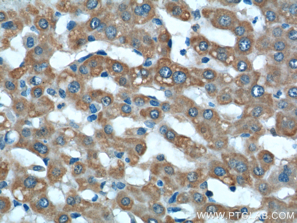 iNOS Antibody 18985-1-AP | Proteintech