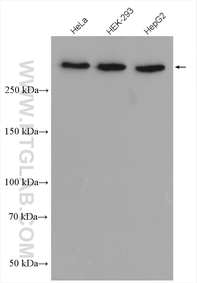 NOTCH1 Antibody 20687-1-AP | Proteintech