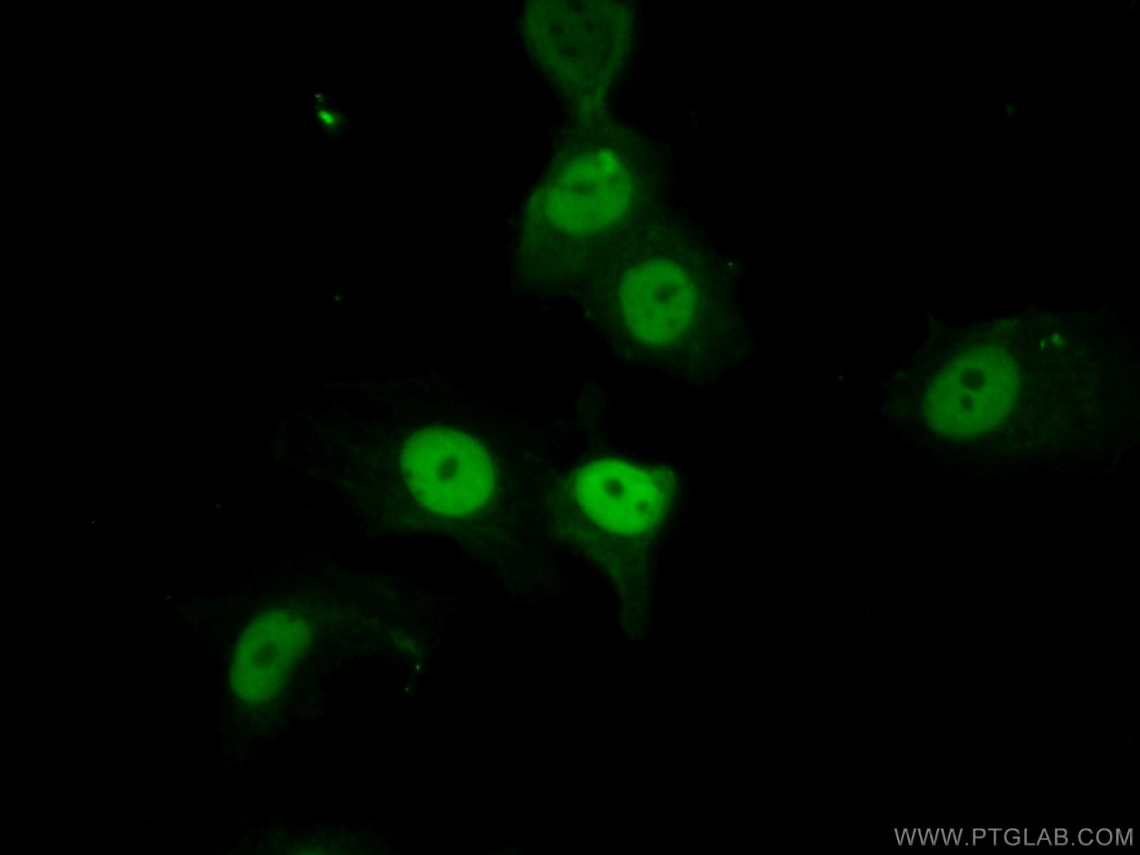 P21 Antibody 10355-1-AP | Proteintech