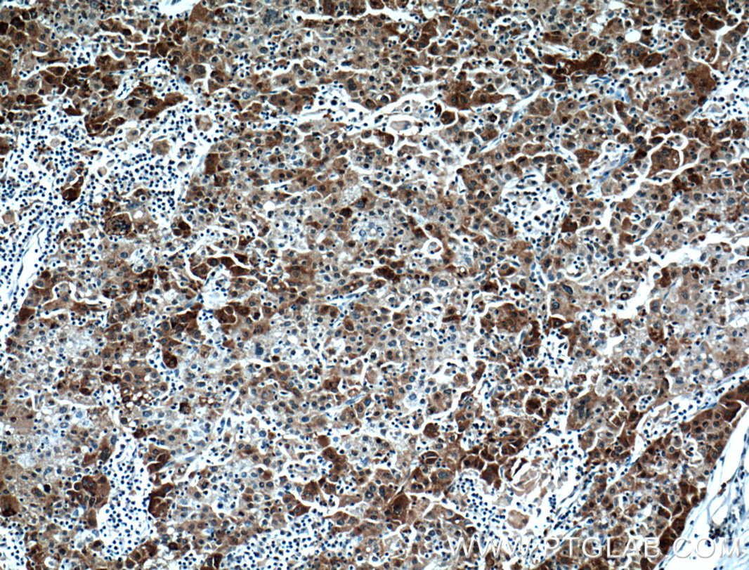 P62/SQSTM1 Antibody 66184-1-Ig | Proteintech