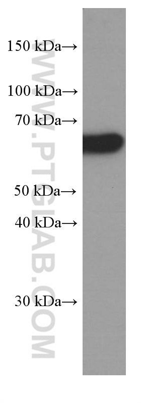 P62/SQSTM1 Antibody 66184-1-Ig | Proteintech