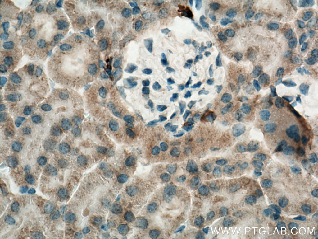 PARK2/Parkin Antibody 14060-1-AP | Proteintech